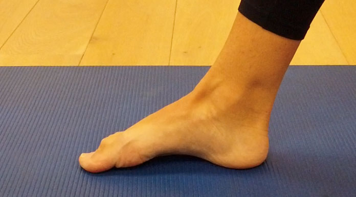 Sperone calcaneare: clinica e terapia - Dott. Luca Barni